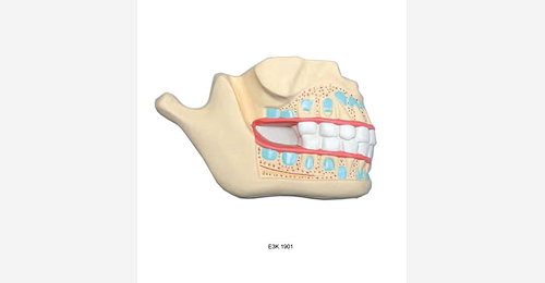 Primary Teeth/deciduous teeth, enlarged,1part