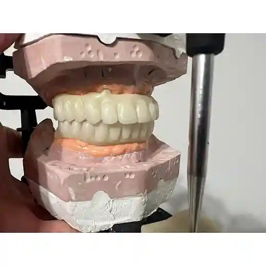 multilayer PMMA disc , Dental PMMA material , Multilayered dental ...