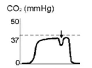 [Pet Diagnosis and Treatment] Why can't we ignore the monitoring of ...