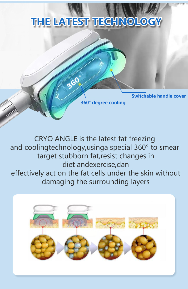 China Fat freezing Muscle building cryo ems -KEYLASER