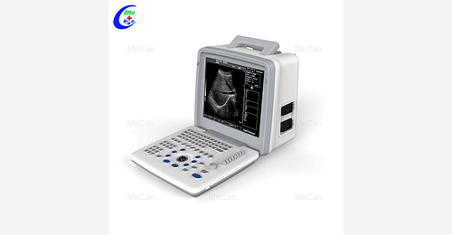 Portable Medical B/W Ultrasound Scanner For Hospitals